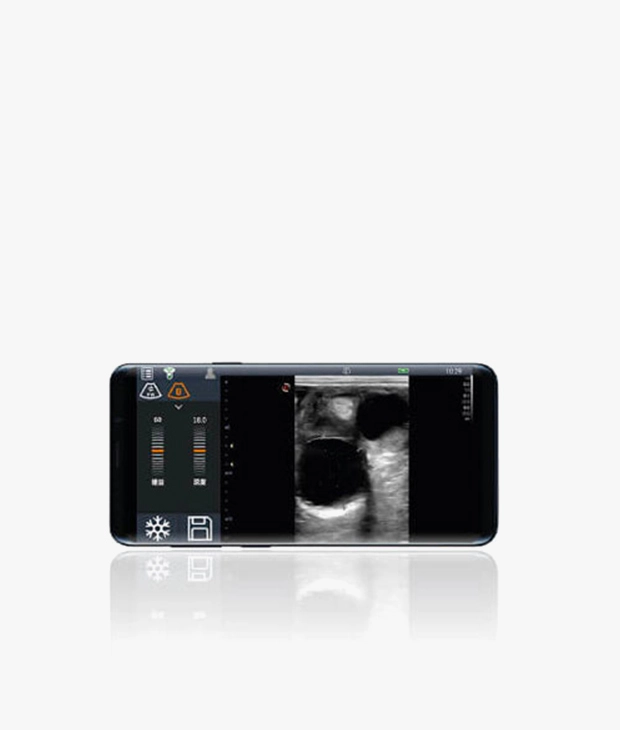 Vet Ultrasound Systems: form cart-based to compact portable - Esaote